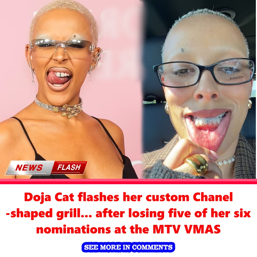 Doja Cat flashes her custom Chanel-shaped grill… after losing five of ...