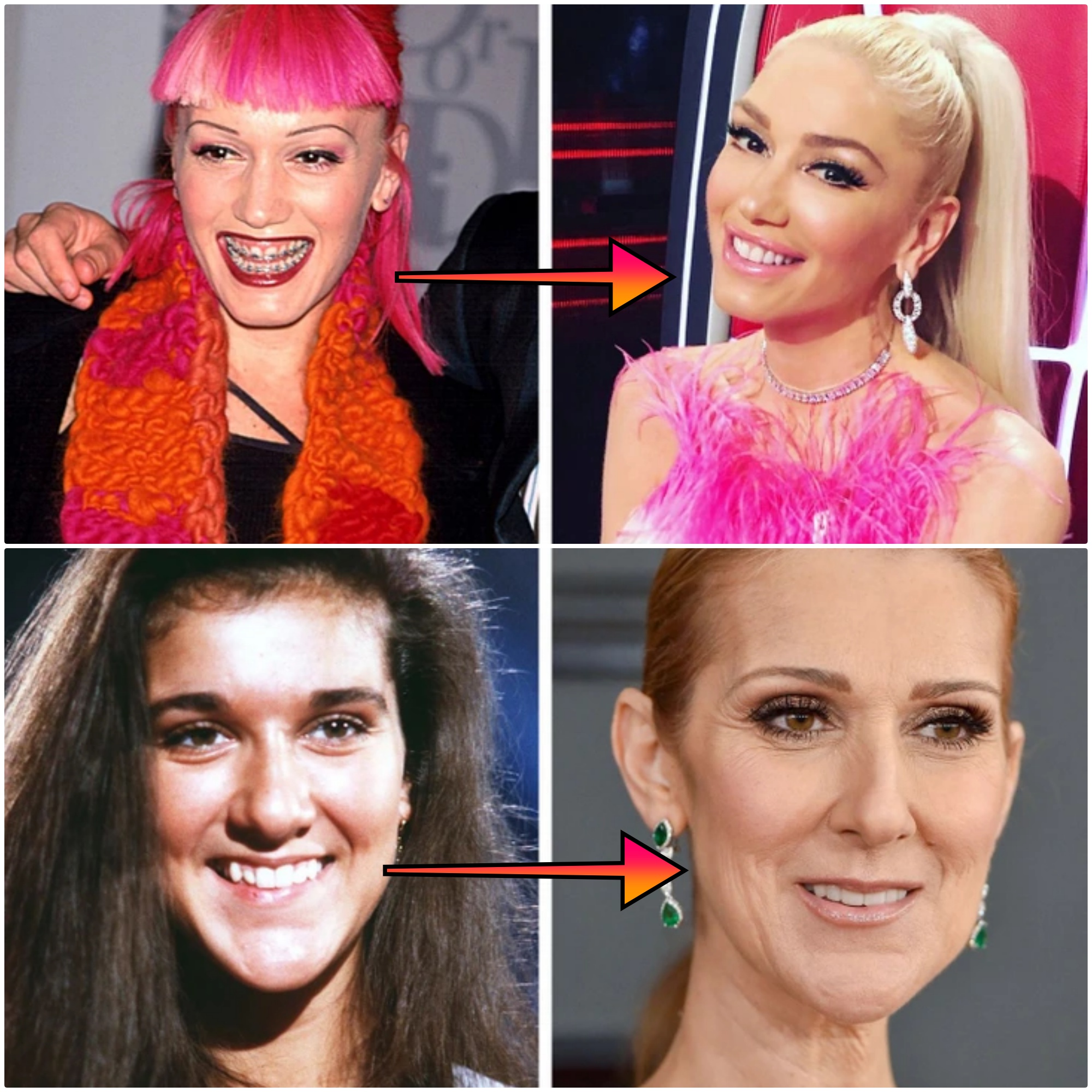Amazing Change: How the Smiles of 15 Celebrities Changed After They ...