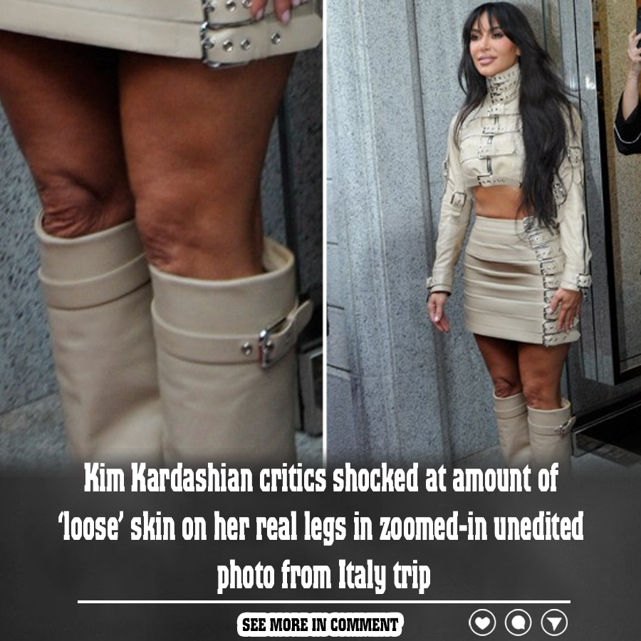 Kim Kardashian critics shocked at amount of ‘loose’ skin on her real legs in zoomed-in unedited ...