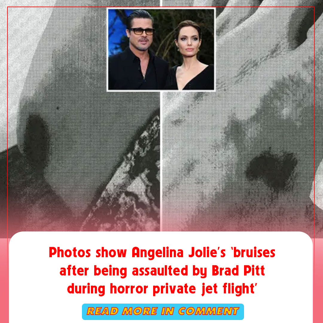 Photos show Angelina Jolie’s ‘bruises after being assaulted by Brad ...