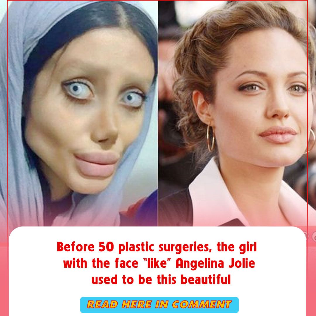 Before 50 plastic surgeries, the girl with the face “like” Angelina ...