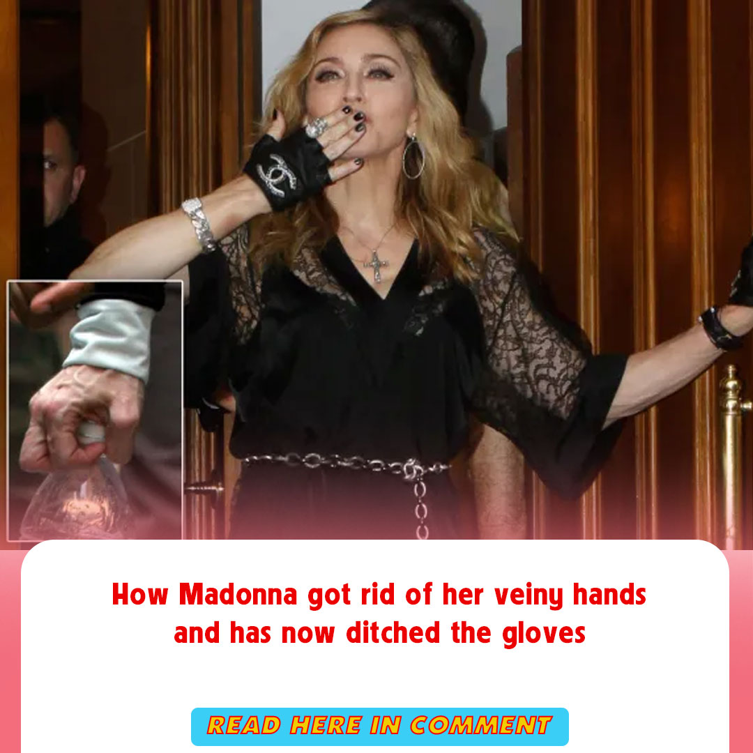 How Madonna got rid of her veiny hands and has now ditched the gloves ...