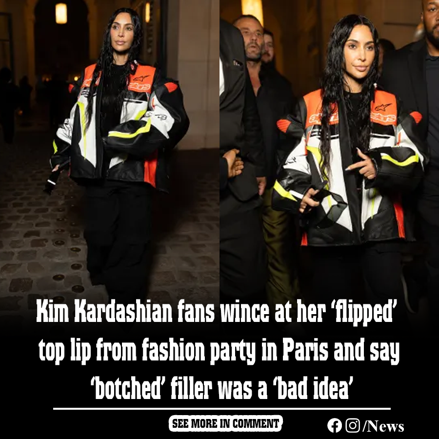 Kim Kardashian fans wince at her ‘flipped’ top lip from fashion party ...