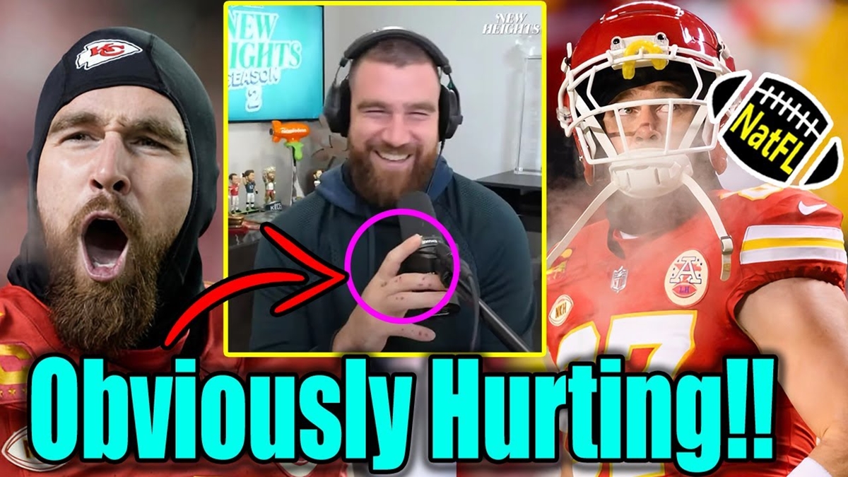 OH MY GOD! Travis Kelce raises injury concerns as NFL fans discover cut and beaten hands ...