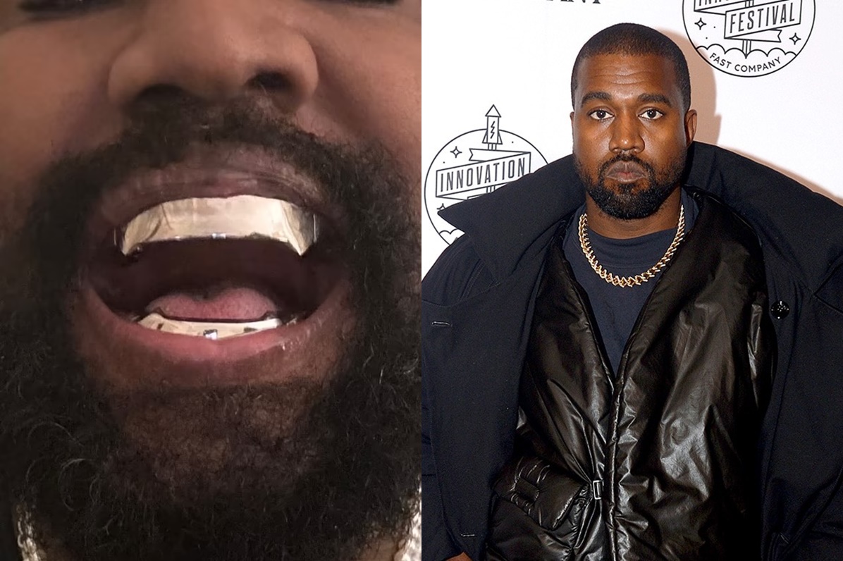 Top dentist reveals BIG problem with Kanye West's new titanium teeth ...