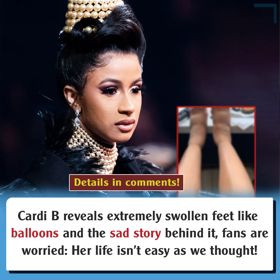 Cardi B reveals the sad story behind her extremely swollen feet like ...