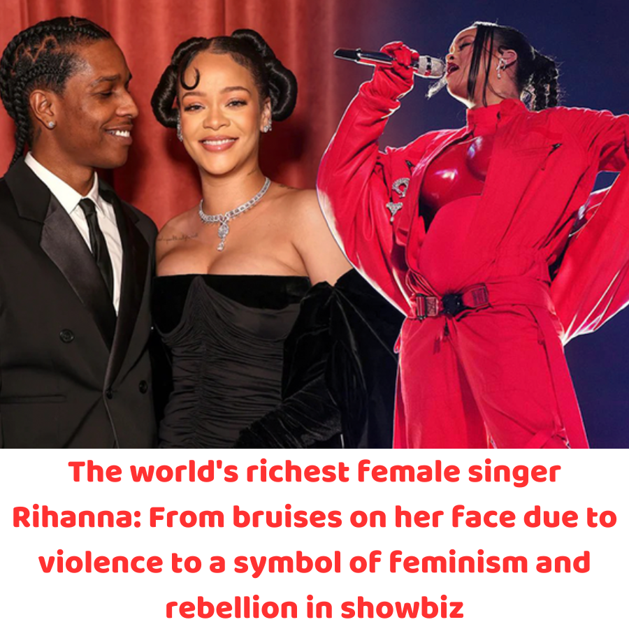 The world's richest female singer Rihanna: From bruises on her face due ...