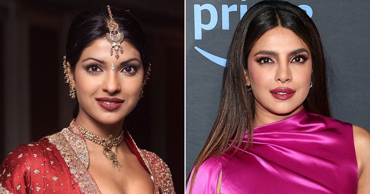 Priyanka Chopra gets candid about botched face surgery which led to her ...