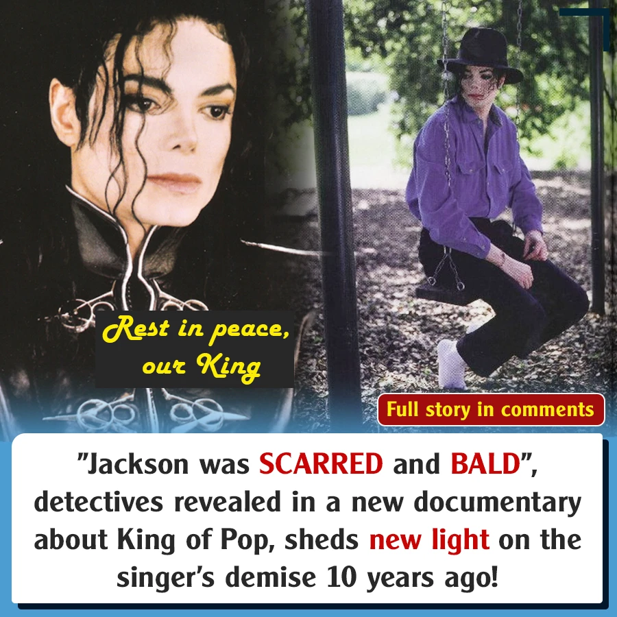 Jackson was scarred bald, detectives revealed in a new documentary ...