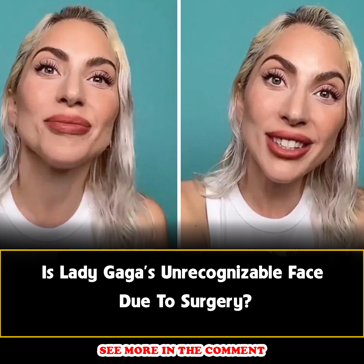 (X) Is Lady Gaga's Unrecognizable Face Due To Surgery? - News