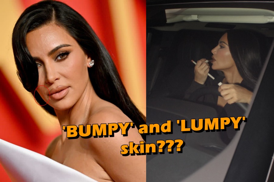 Fans Joke About Kim Kardashian’s Exposed ‘Lumpy’ and ‘Bumpy’ Skin at the Vanity Fair Oscars ...