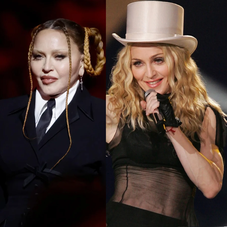 Fans were shocked by Madonna's disfigured face at the Grammys - News