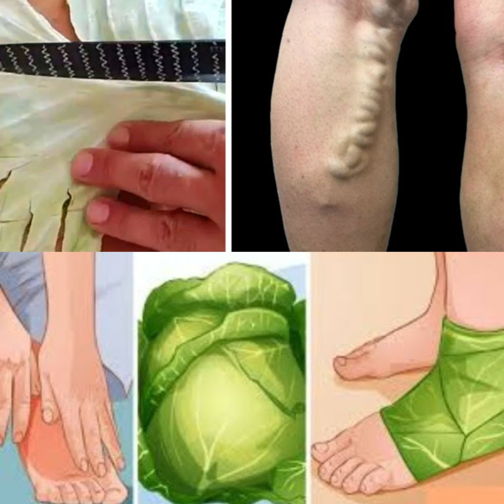Top 7 Health Benefits of Cabbage Leaves For Skin, Heart And More - News