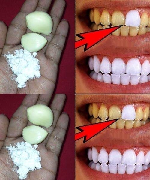 Teeth Whitening at Home in 2 Minutes! Naturally Whiten Yellow Teeth ...