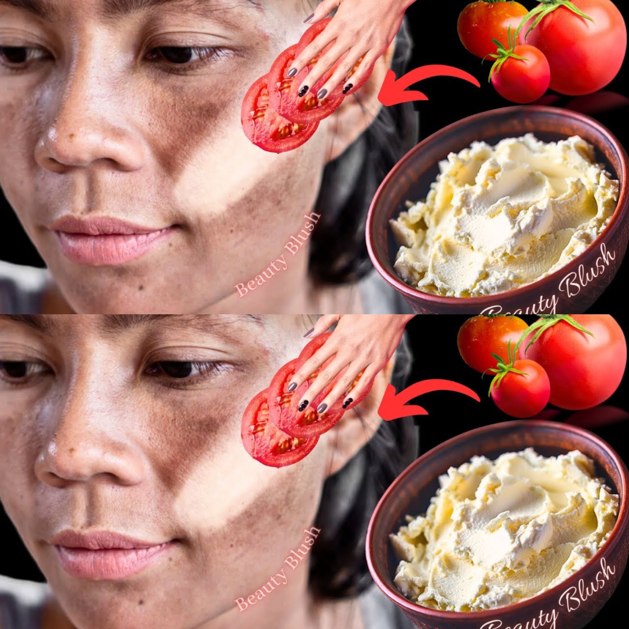 Look Fresh & Youthful with This Simple Tomato & Cornstarch MaskFeel ...