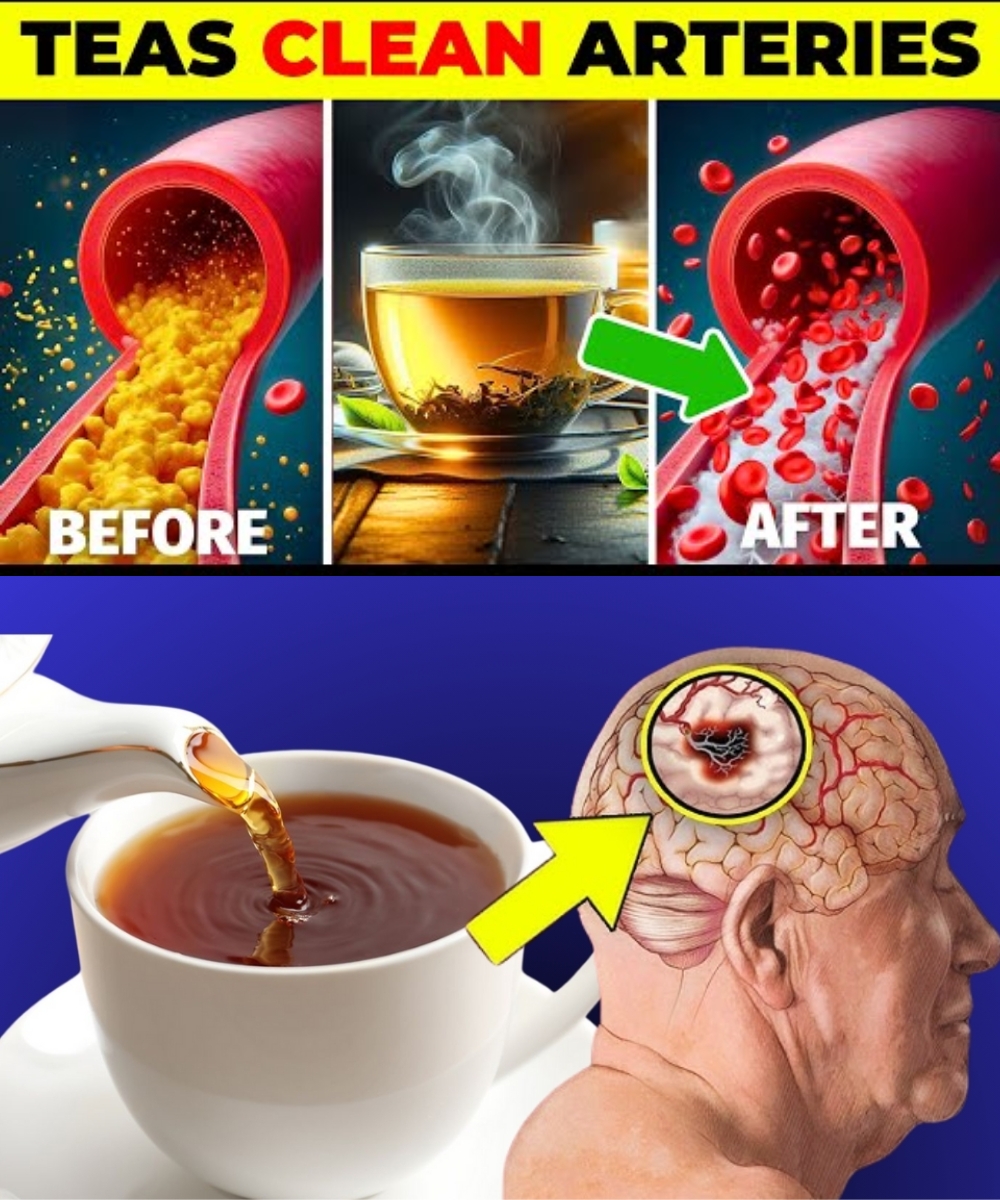 Better Than Aspirin! These Teas Prevent Blood Clots Naturally After 50 ...